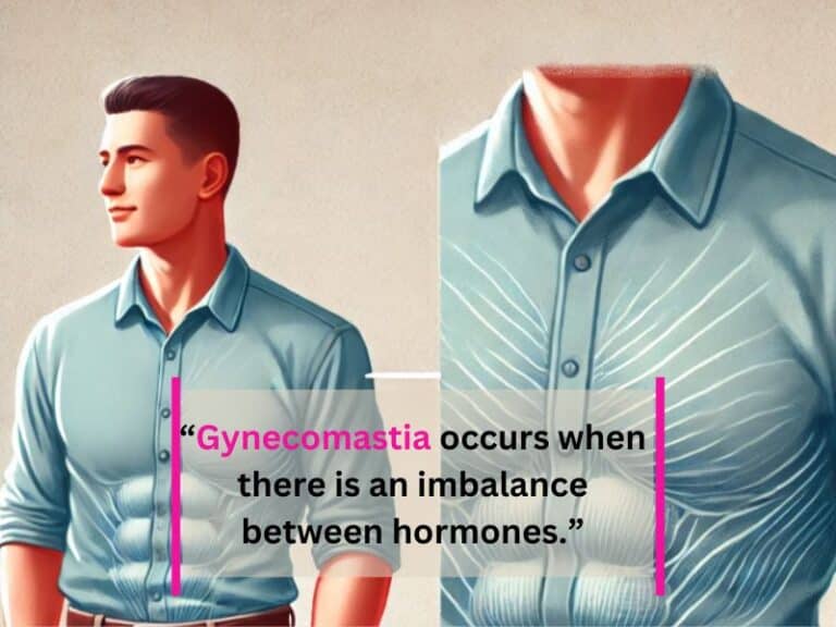 Understanding Different Gynecomastia Stages - Dr. Rice